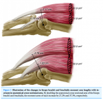 A Larger Muscle is a Stronger Muscle Due to Increased Strength and ...